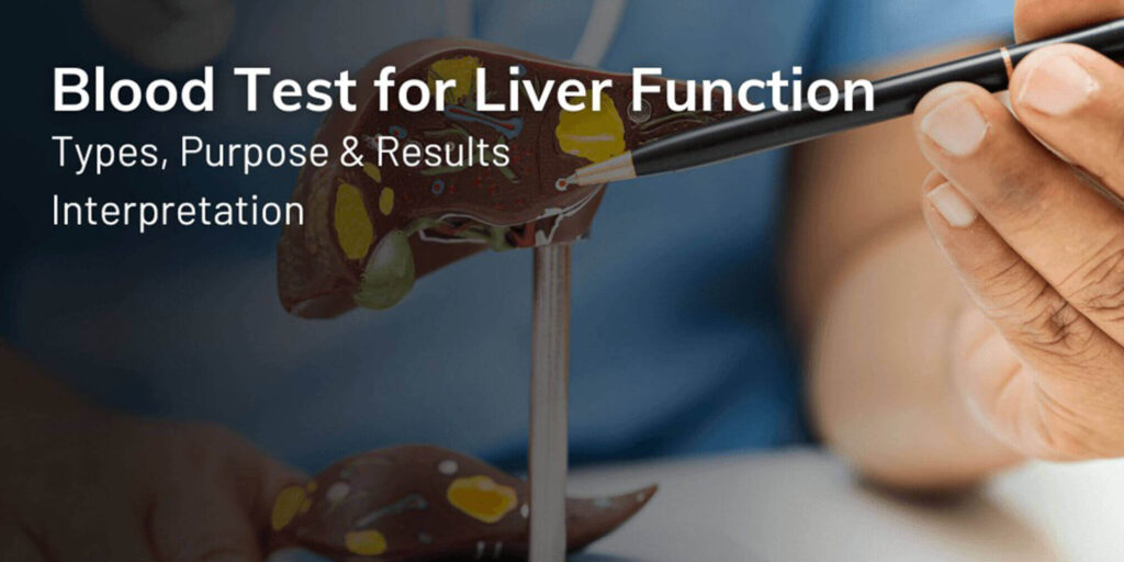 Blood Test for Liver Function: Types, Purpose & Results Interpretation ...