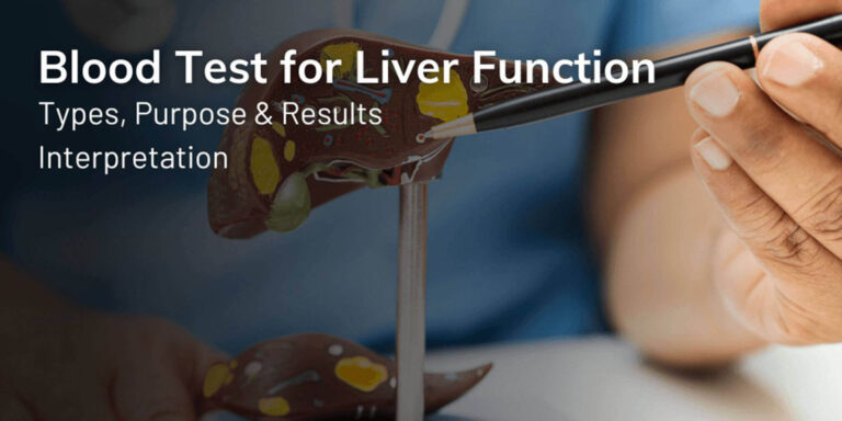 Blood Test for Liver Function: Types, Purpose & Results Interpretation ...